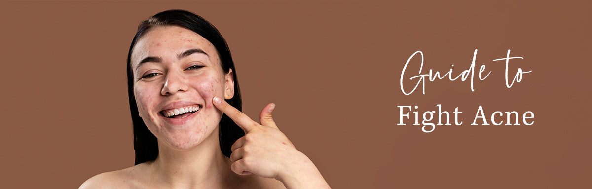 Expert Tips for Combating Acne: A Complete Guide – Kass