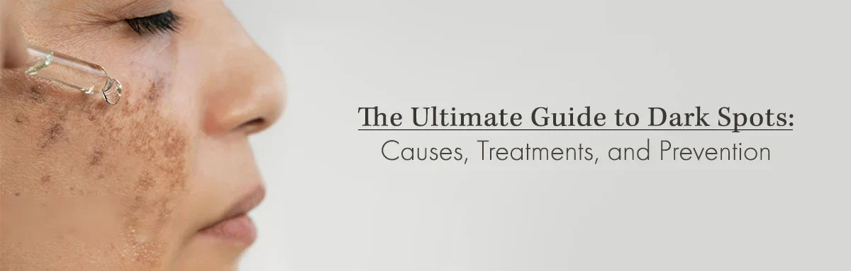 The Ultimate Guide to Dark Spots: Causes, Treatments, and Prevention – Kass
