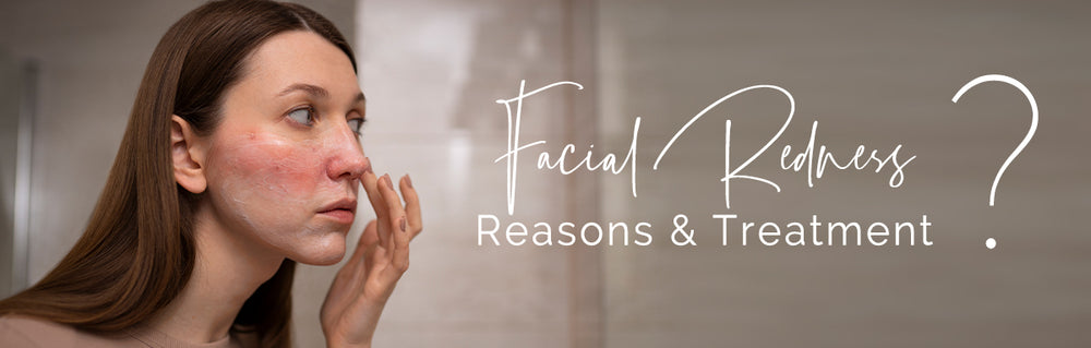 Reasons for Facial Redness and How to Tackle it? – Kass