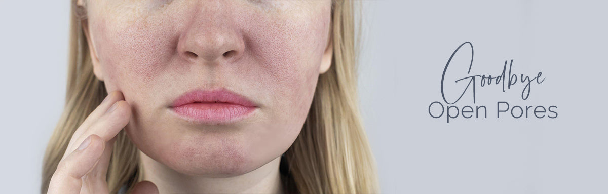 Say Goodbye to Large Pores: Top Pore Minimizer Serums Revealed – Kass