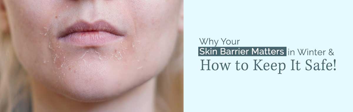 Why Your Skin Barrier Matters in Winter And How to Keep It Safe! – Kass