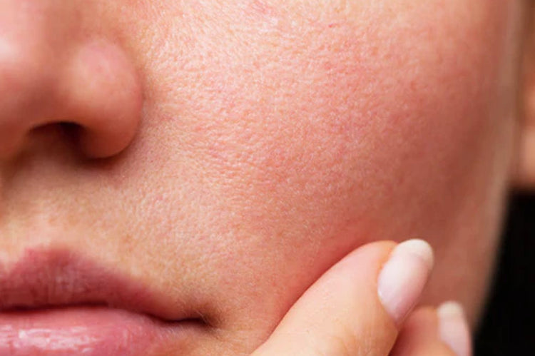 Pore Minimizing Serum: 10% Niacinamide & Calendula - Kass